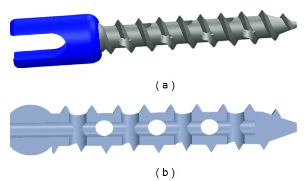 CD Horizon Fenestrated Screw Set | Michelson Technology at Work