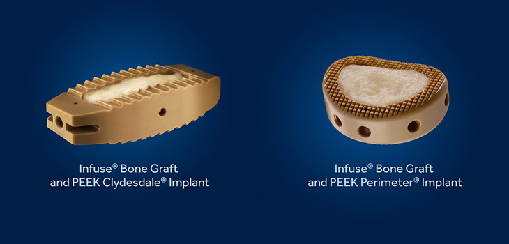 FDA Approved INFUSE for Two More Spine Devices | Pivox